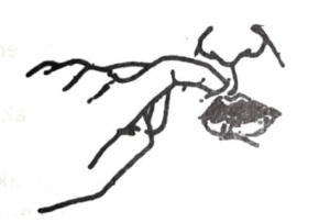 Berbagai Macam Refleks dan Cara Pemeriksaannya – Gustinerz.com