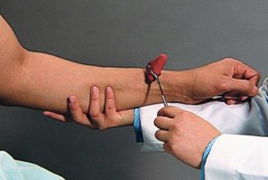 Berbagai Macam Refleks dan Cara Pemeriksaannya – Gustinerz.com