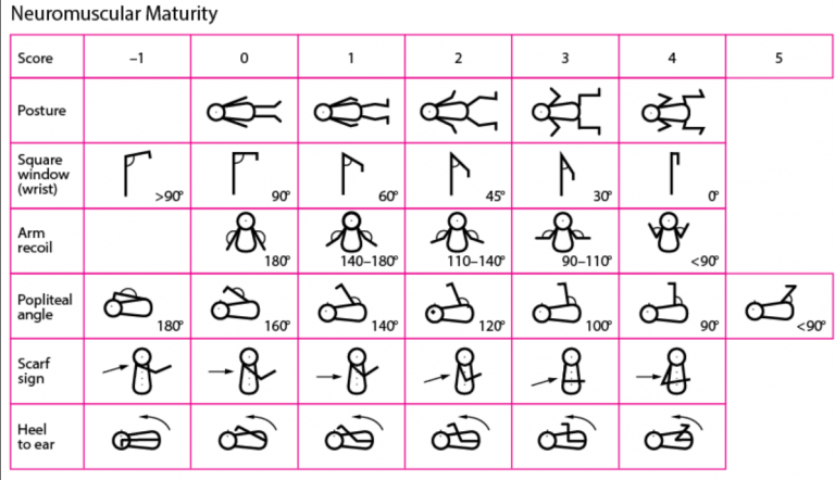 Menentukan Usia Gestasi Bayi Baru Lahir dengan Ballard Score ...