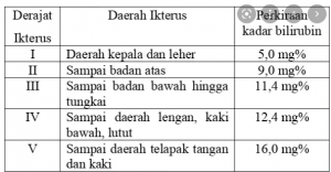 Cara Menghitung Derajat Ikterus Neonatus Kramer – Gustinerz.com