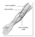 Prosedur Pengambilan Sampel Darah Vena – Gustinerz.com